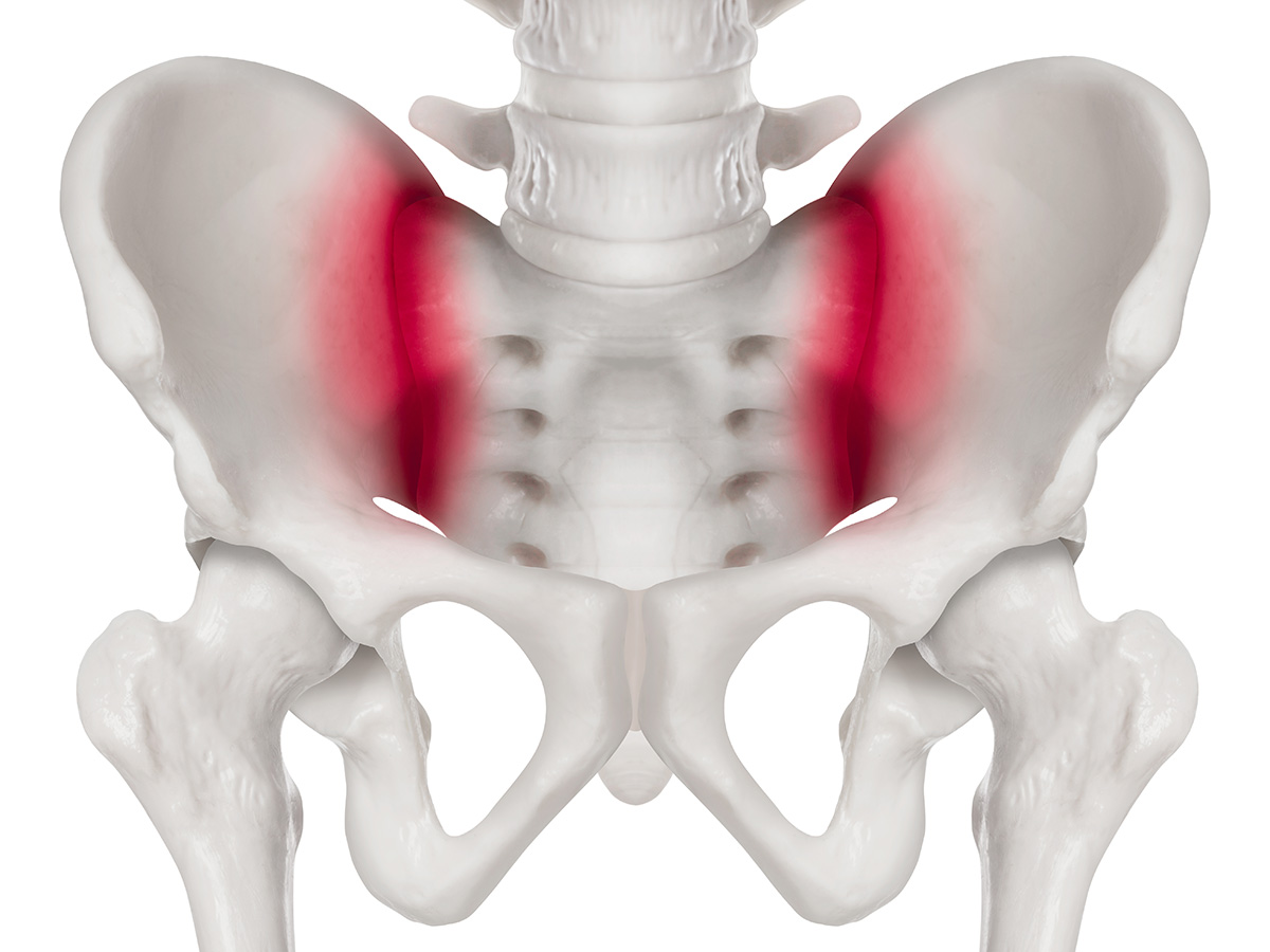 Sakit Tulang Pinggul | Physiomobile